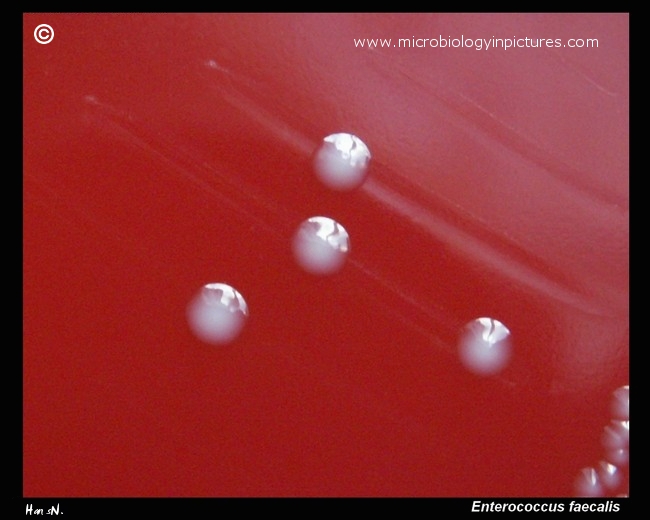 Enterococcus Faecalis On Blood Agar Colony